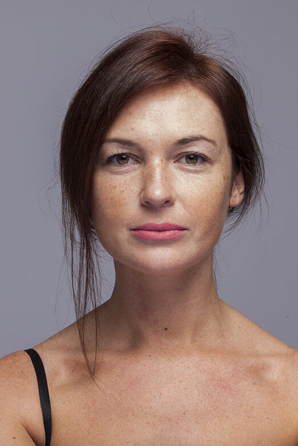 Dull Complexion, Blotchy Skin (Hyperpigmentation) – Helwé Natural Skincare